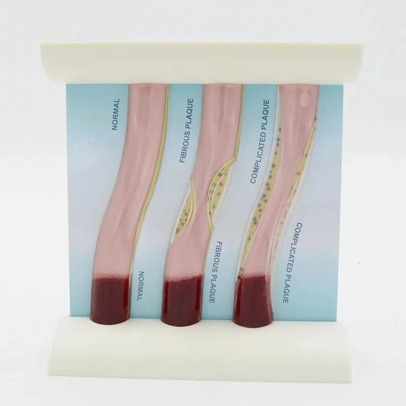 Cholesterol & Blood Model