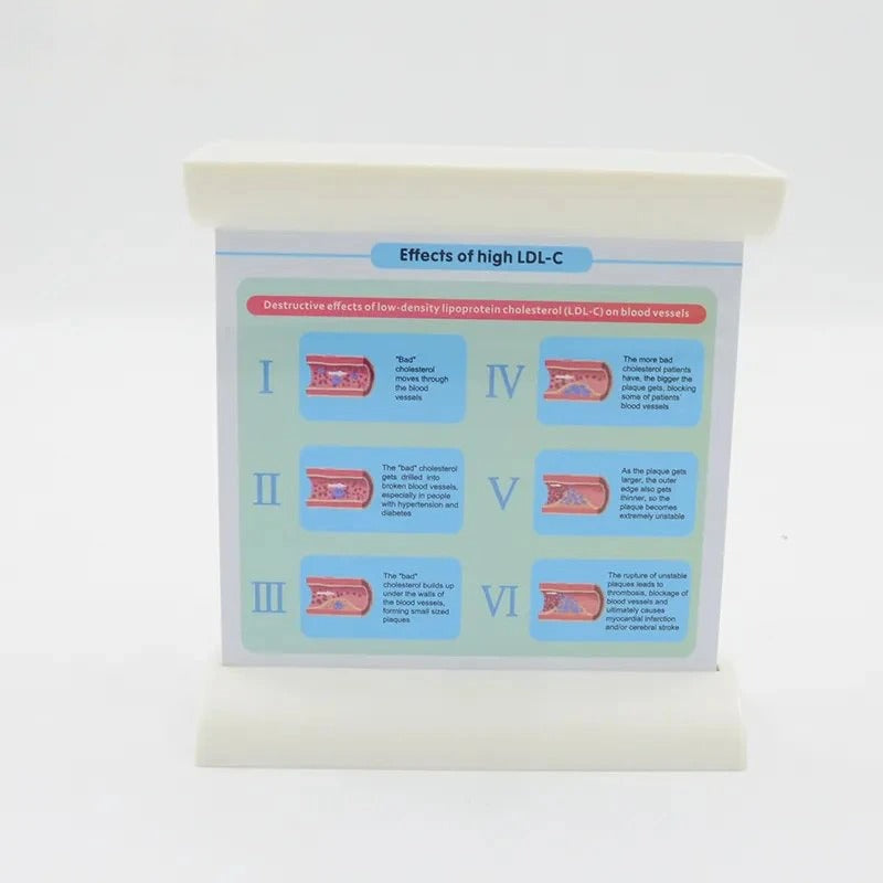 Cholesterol & Blood Model