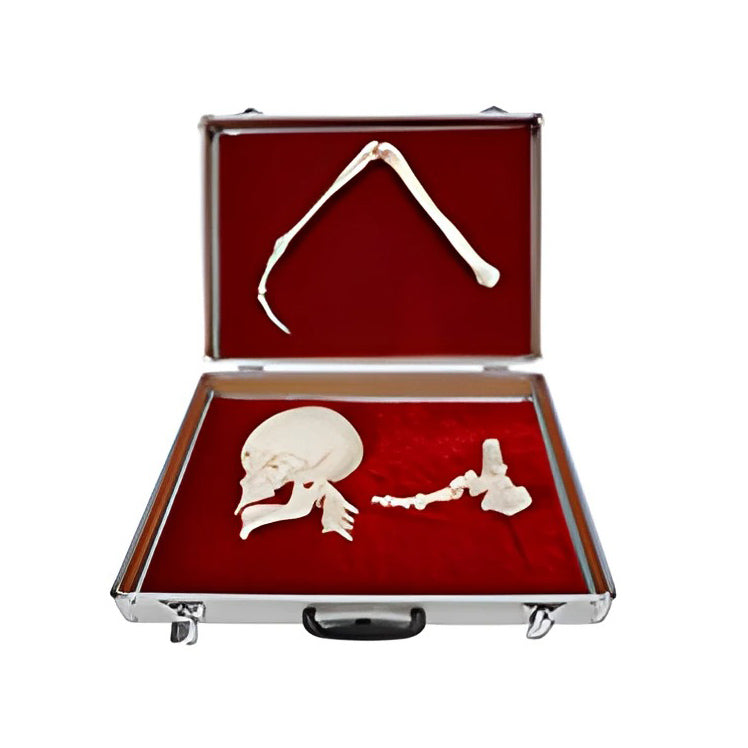 Human Skeletal Lever Classification Model