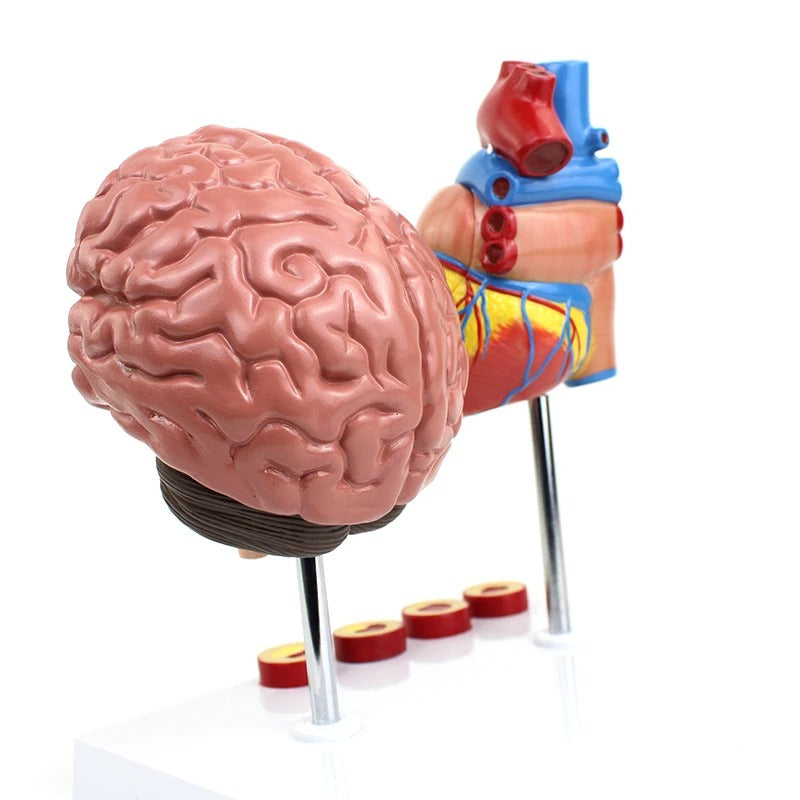 Hypertension Model – Dr Wong Anatomy