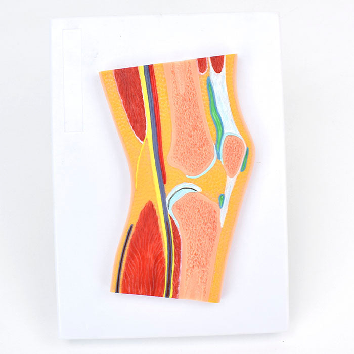 Knee Joint Section Model, Life-Size – Dr Wong Anatomy
