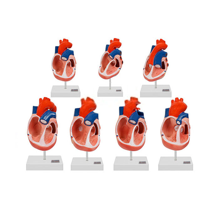 Congenital Heart Malformation, 7 Models – Dr Wong Anatomy
