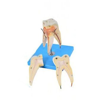 Upper Triple-Root Molar Human Tooth Model, 3 part