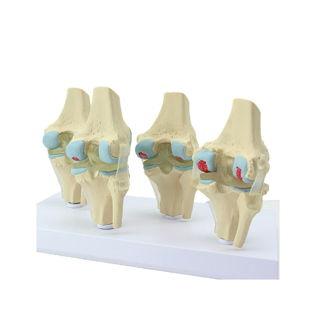 Knee Joint Anatomy Models