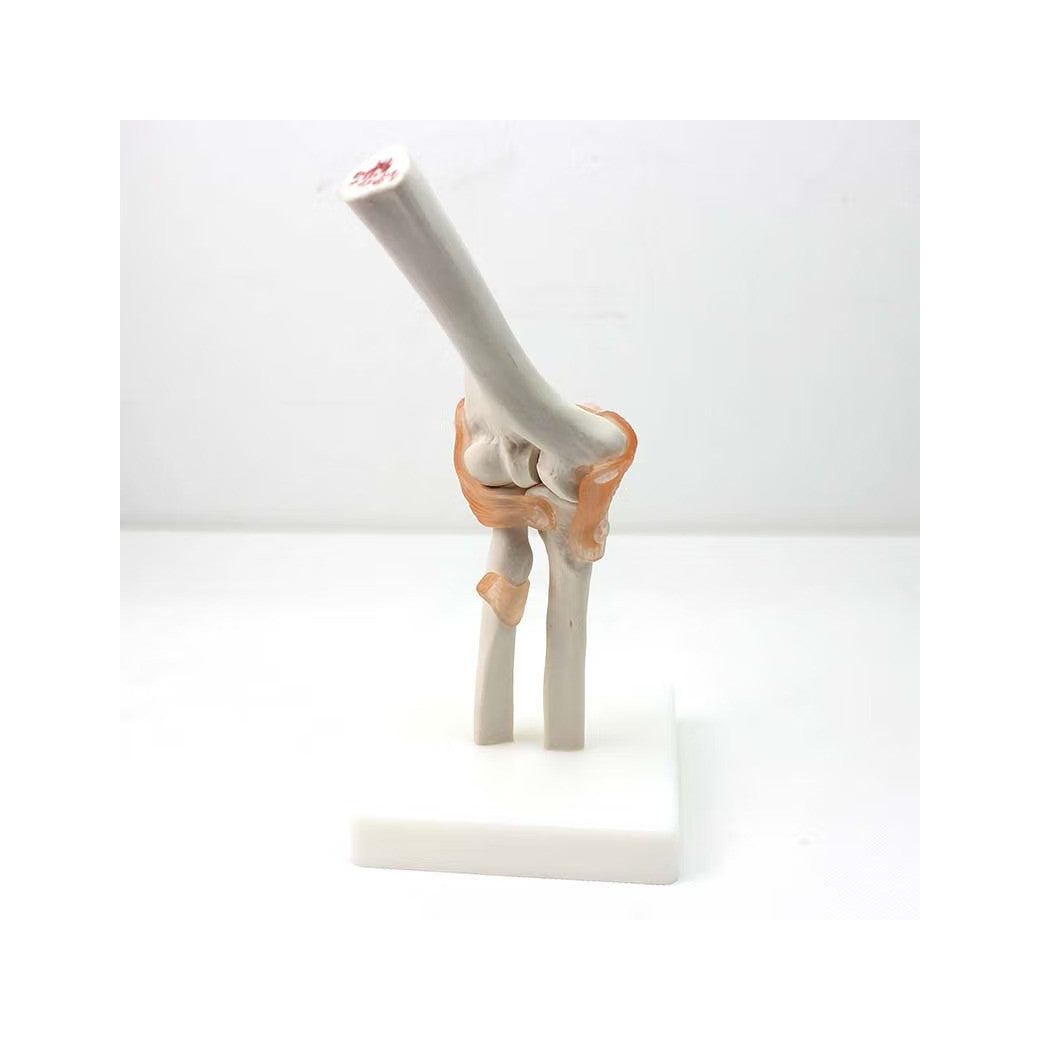 Functional Elbow Joint Model