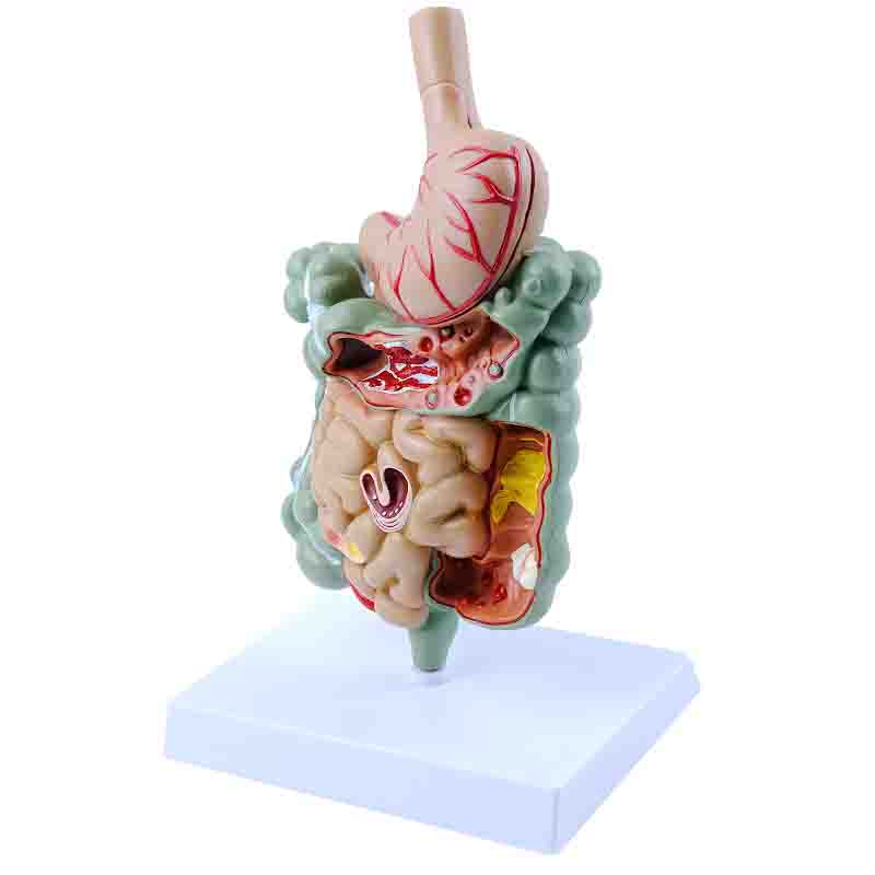 Gastrointestinal Disease Model – Dr Wong Anatomy