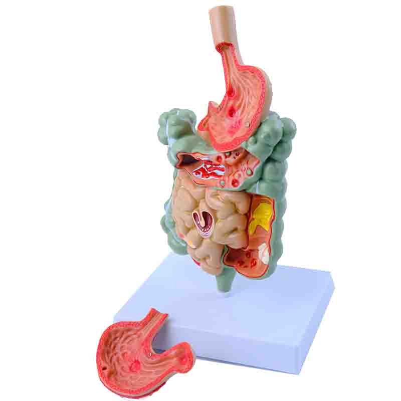 Gastrointestinal Disease Model – Dr Wong Anatomy