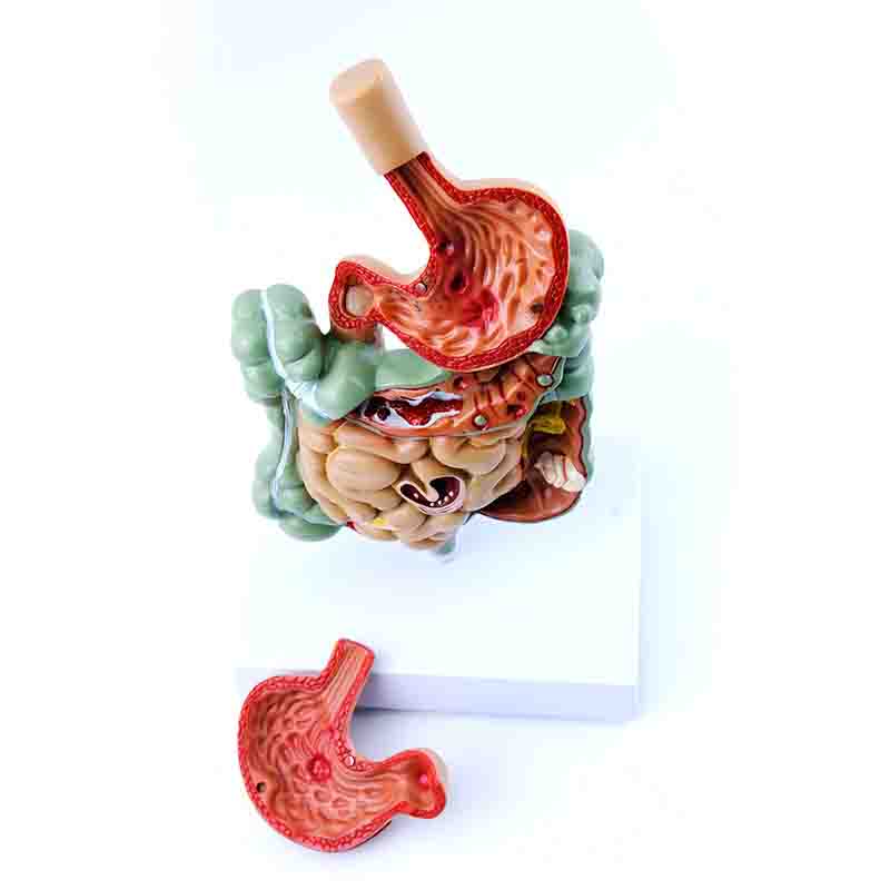Gastrointestinal Disease Model – Dr Wong Anatomy