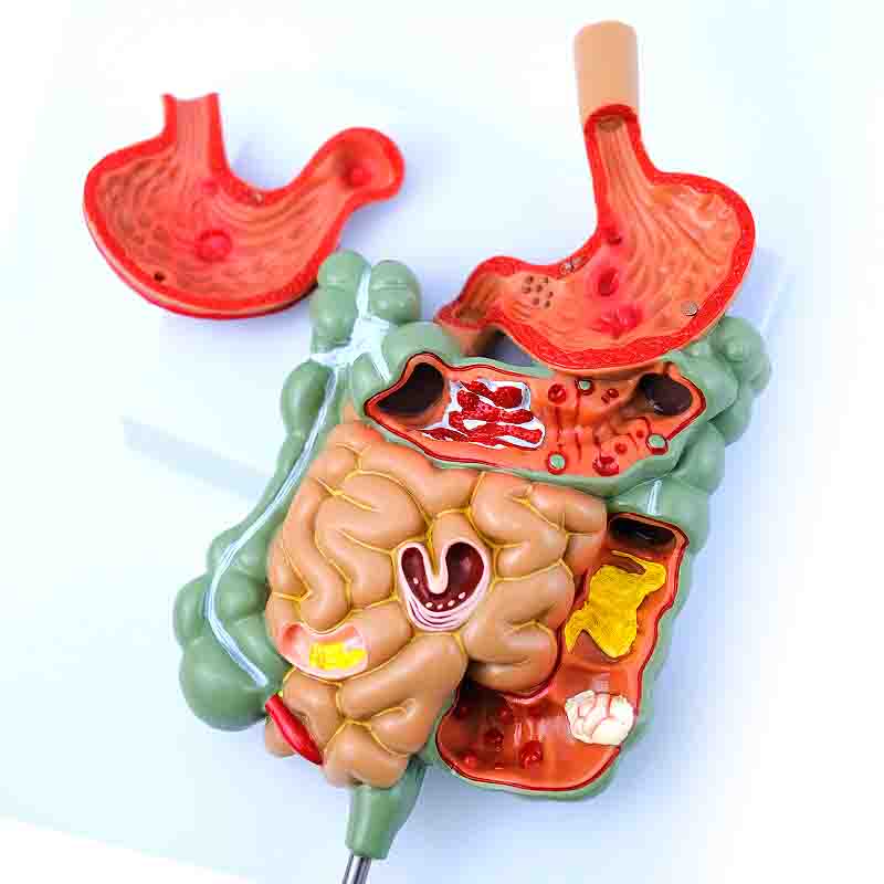Gastrointestinal Disease Model
