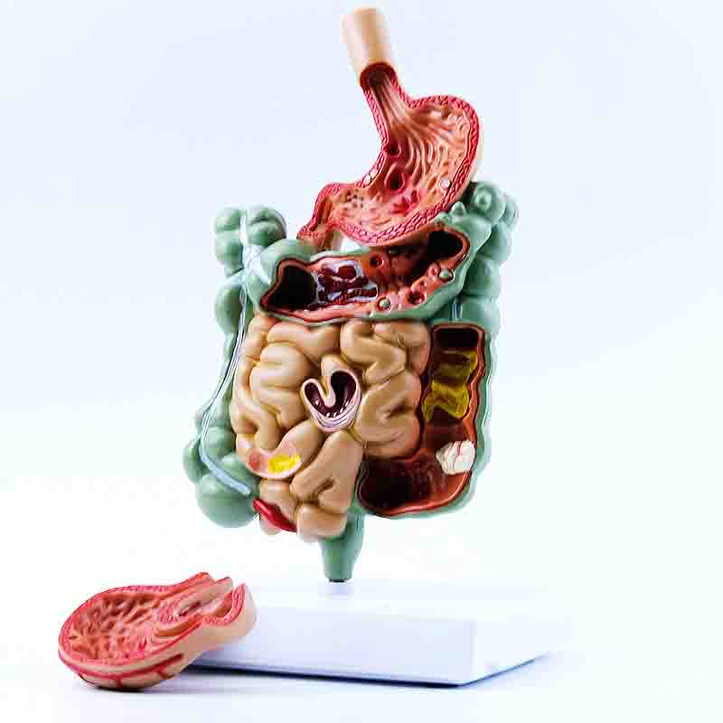 Gastrointestinal Disease Model