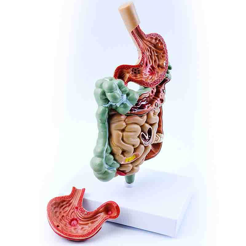 Gastrointestinal Disease Model – Dr Wong Anatomy