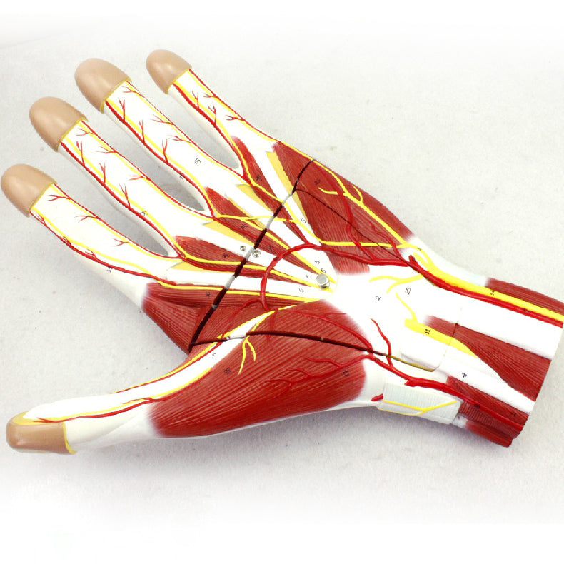 Hand Anatomy Model, 2X Life-Size, 3 Parts