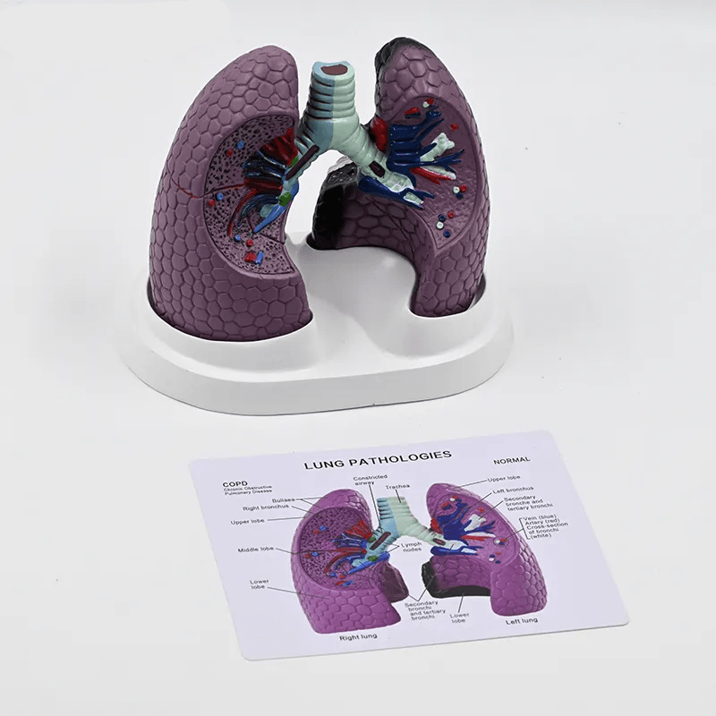 Lung Set Model with Pathologies