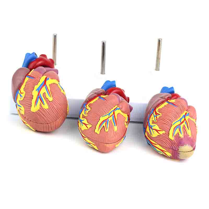 Heart Disease Model Set