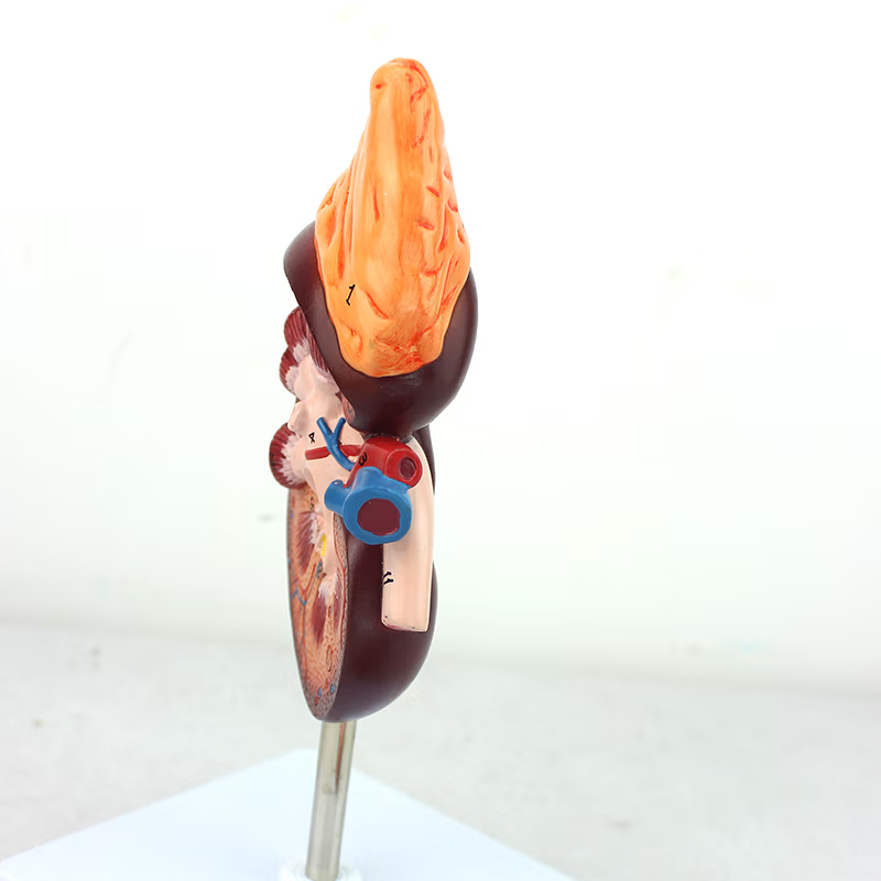 Human Kidney Model, 1.5X Life-Size – Dr Wong Anatomy