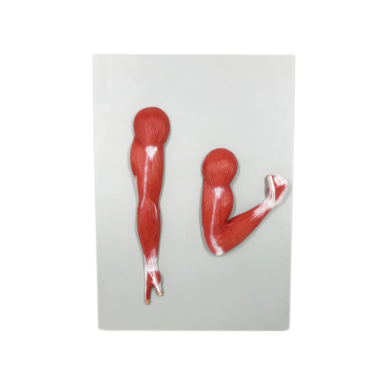 Muscles of the Arm Model – Dr Wong Anatomy
