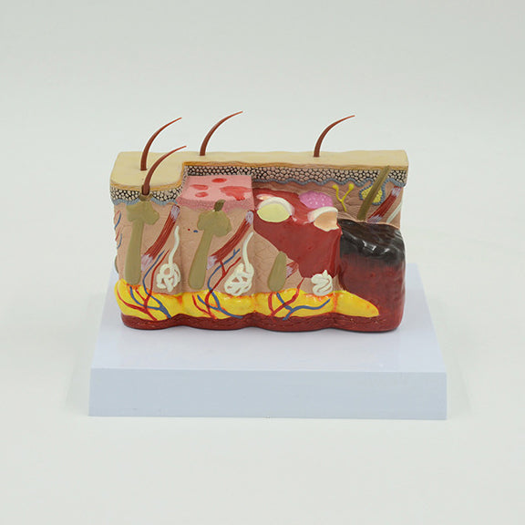 Pathological Model of Burned Skin