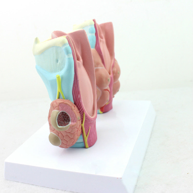 Pathology of Larynx Model, 4 Parts – Dr Wong Anatomy