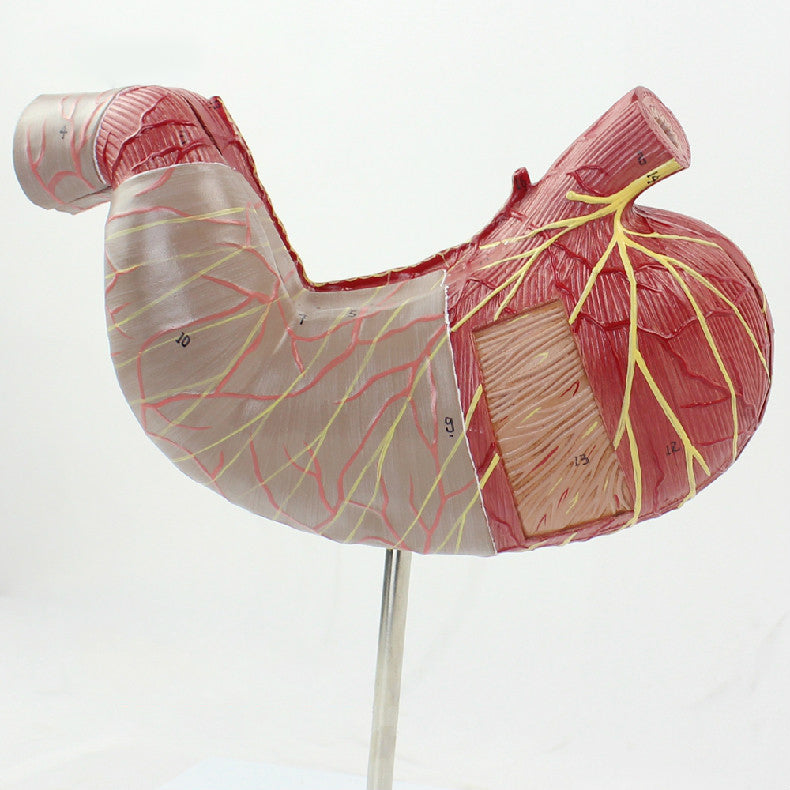 Stomach Model, 1.5X Life-Size，2 Parts
