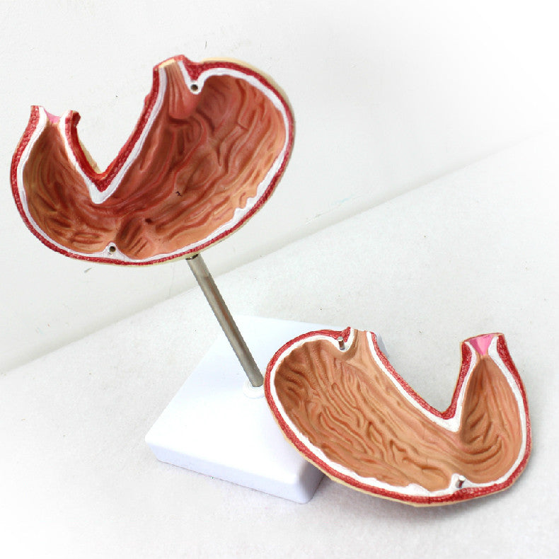Stomach Model, Life-Size, 2 Parts – Dr Wong Anatomy