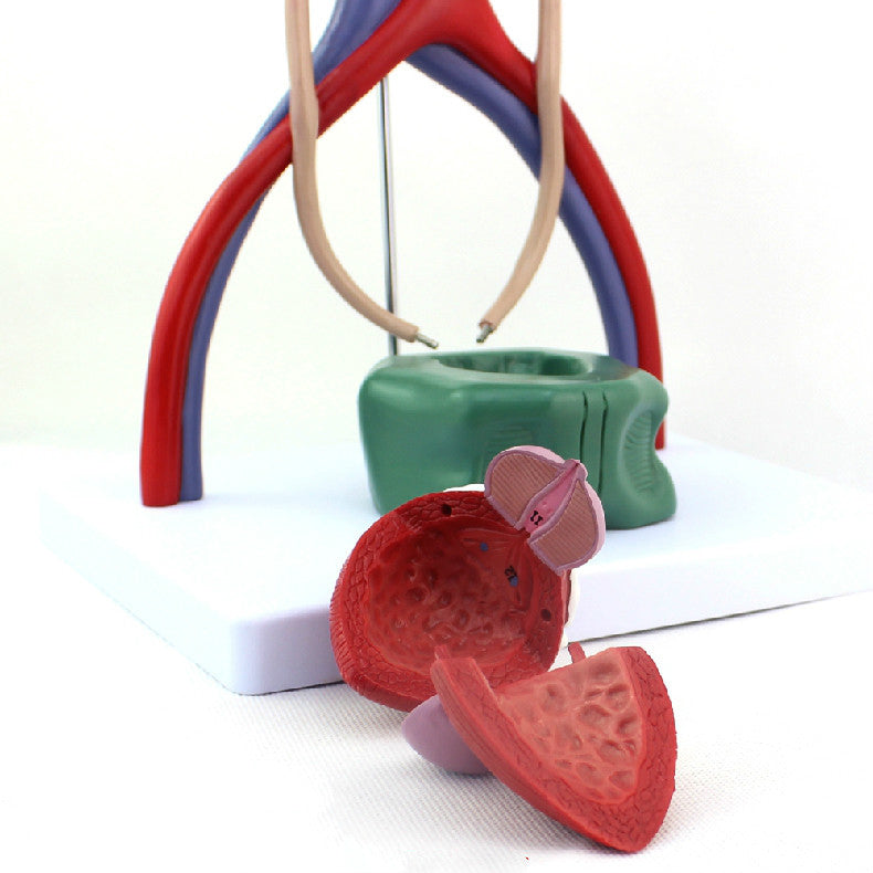 Urinary System Model, 5 Parts