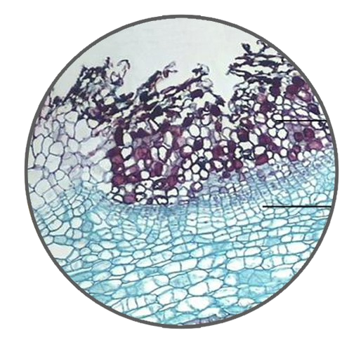 Elder Lenticel, Prepared Microscope Slide – Dr Wong Anatomy