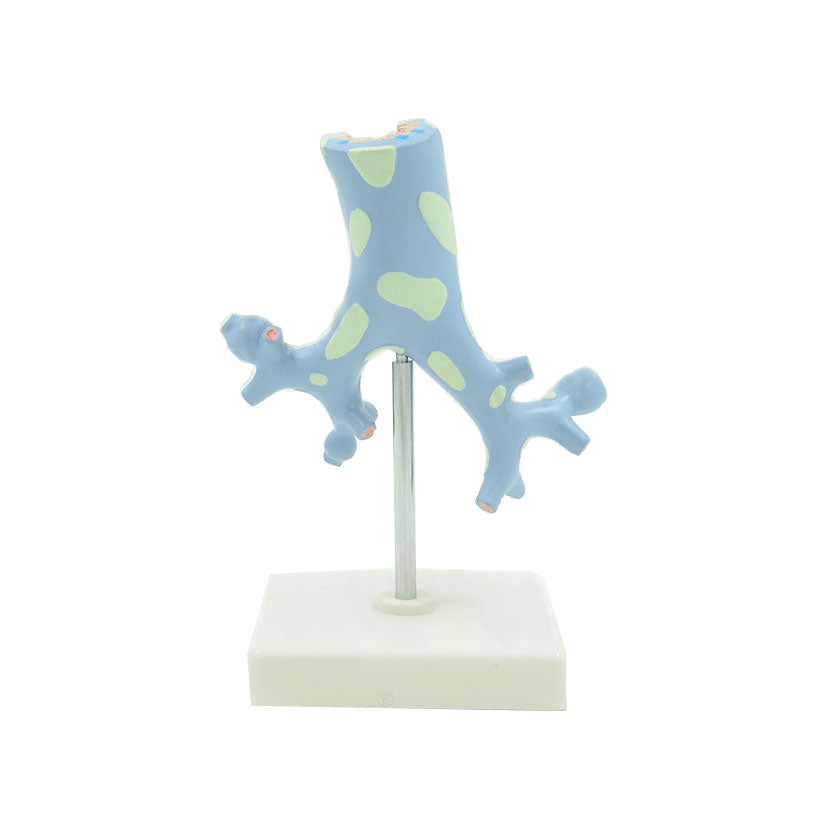 Pathology of the Human Trachea and Bronchi Model