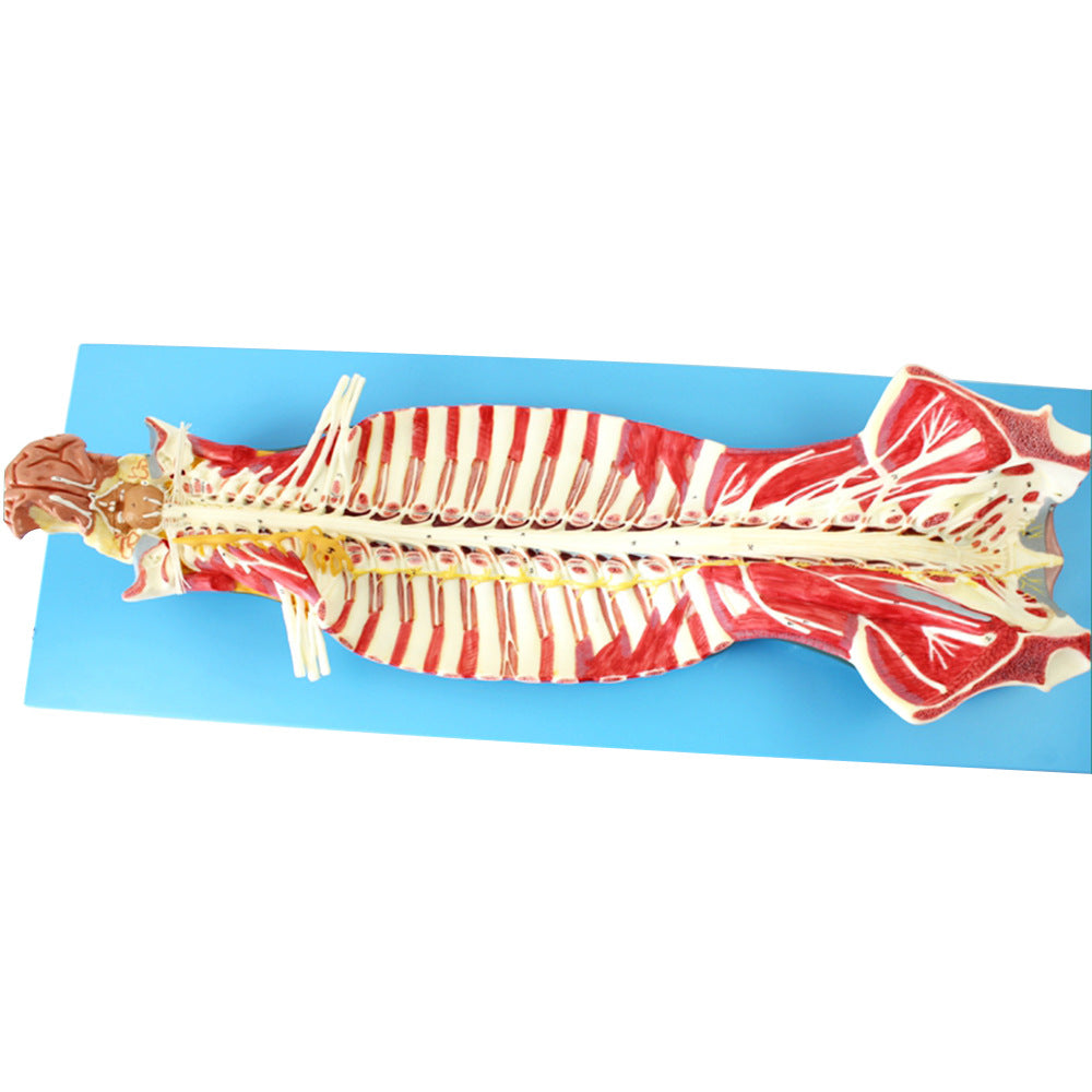 Anatomy Model - Spinal Cord in the Spinal Canal