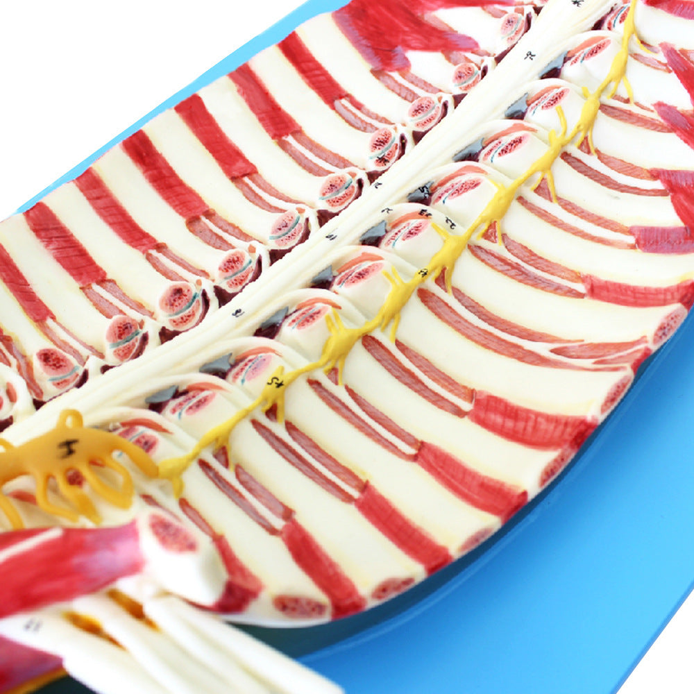 Anatomy Model - Spinal Cord in the Spinal Canal