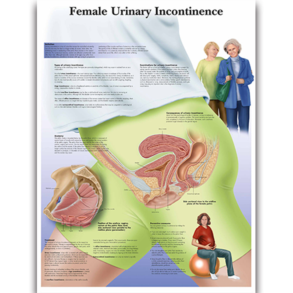 Health Education Chart - Female Urinary Incontinence