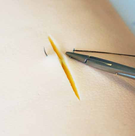 Advance Suture Pad, 3 Layers