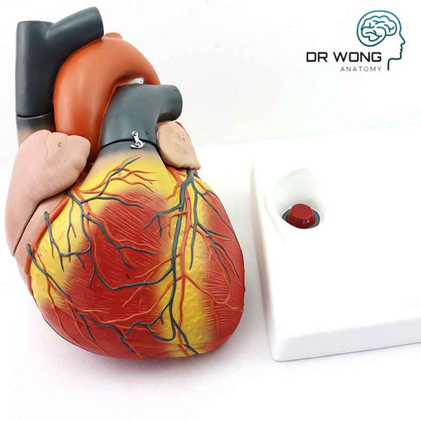 Giant Heart Model, 4X Life-Size, 4 Parts