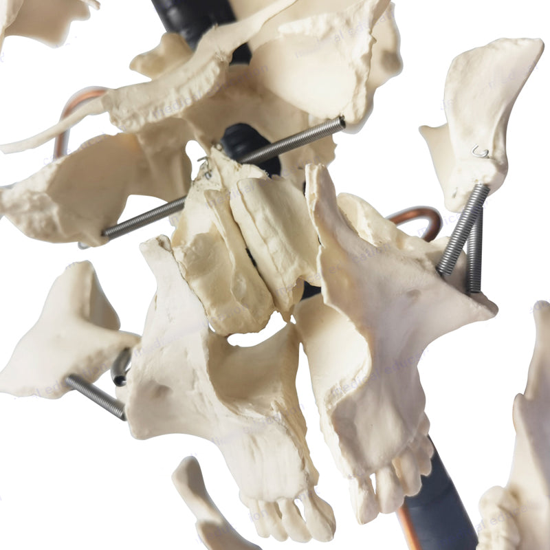 Beauchene Exploded Skull Model