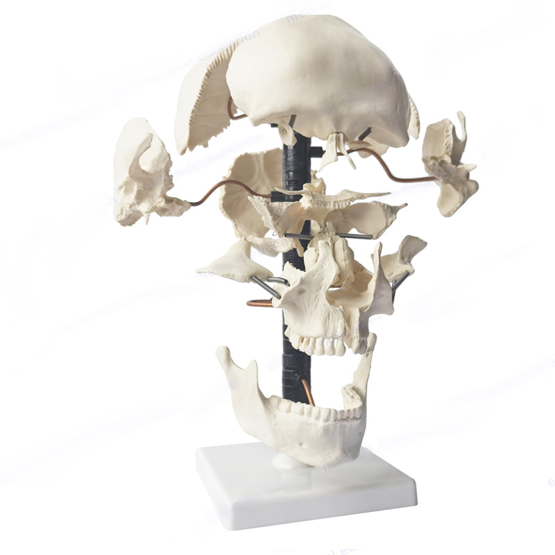 Beauchene Exploded Skull Model