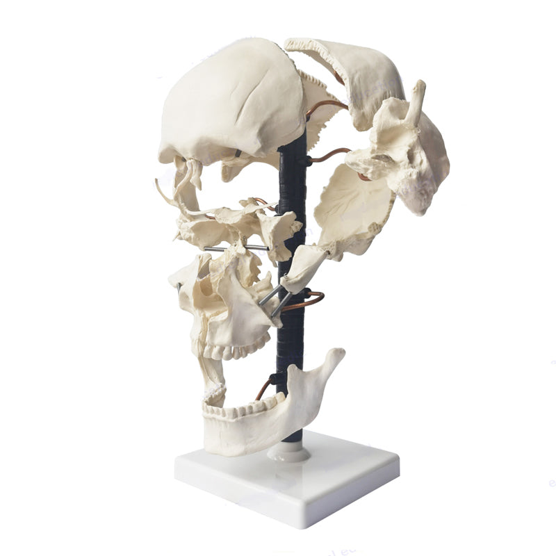 Beauchene Exploded Skull Model