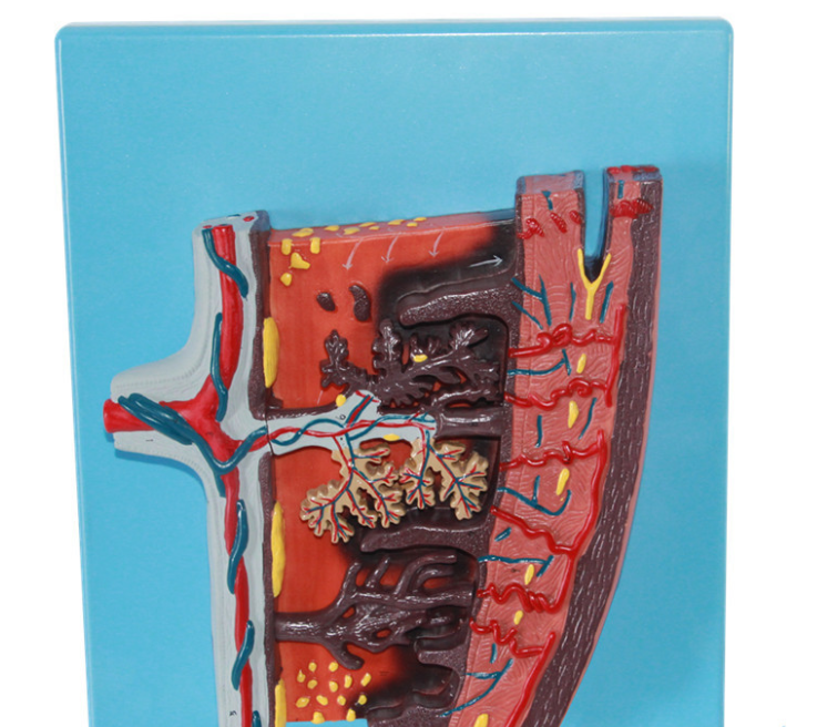 Model of the Placenta, 4X Life-Size