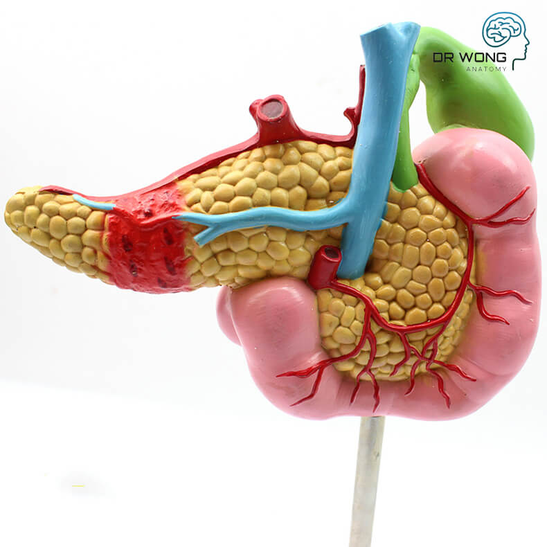Pathological Model of Pancreas, Duodenum, Gallbladder – Dr Wong Anatomy