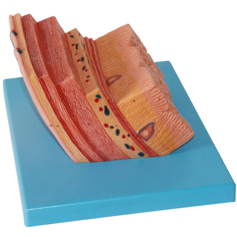 Stomach Wall Model