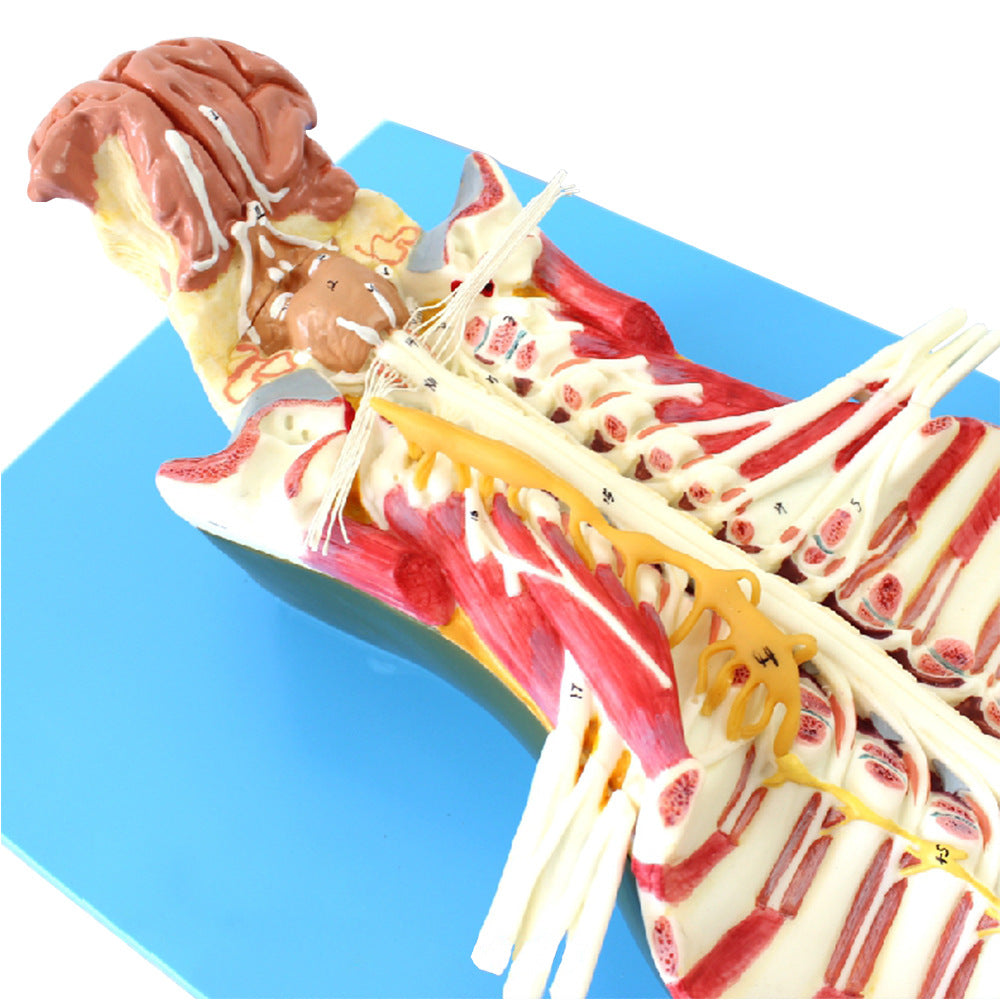 Anatomy Model - Spinal Cord in the Spinal Canal