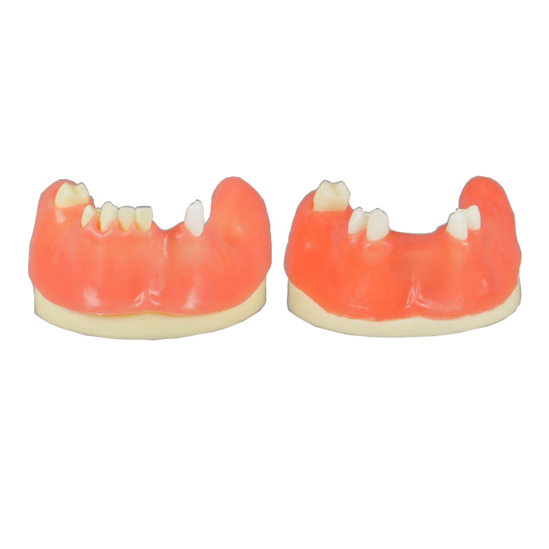 W2004 Dental Implant Practice Model