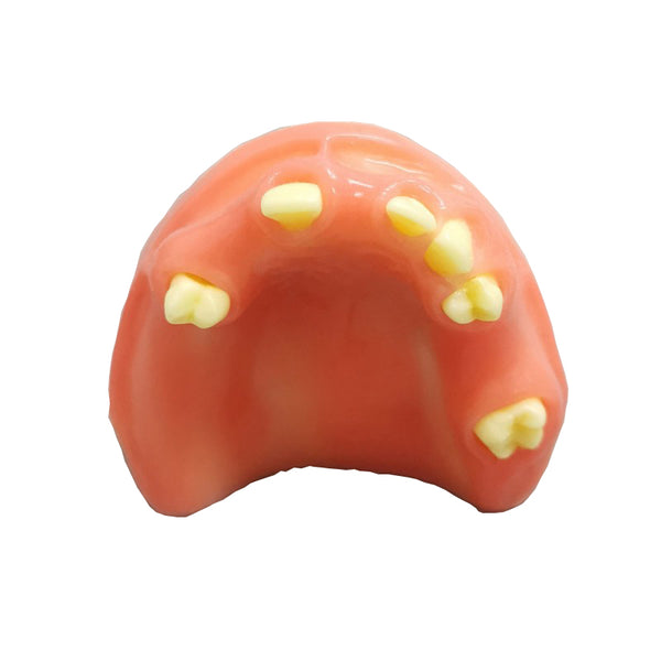 W2024 Dental Implant Practice Model Upper Jaw Model Partially Edentulo