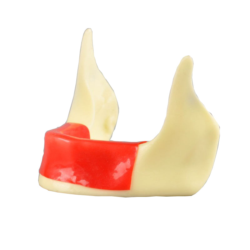 W2025 Dental Implant Practice Model Made of Resin and Cancellous Bone