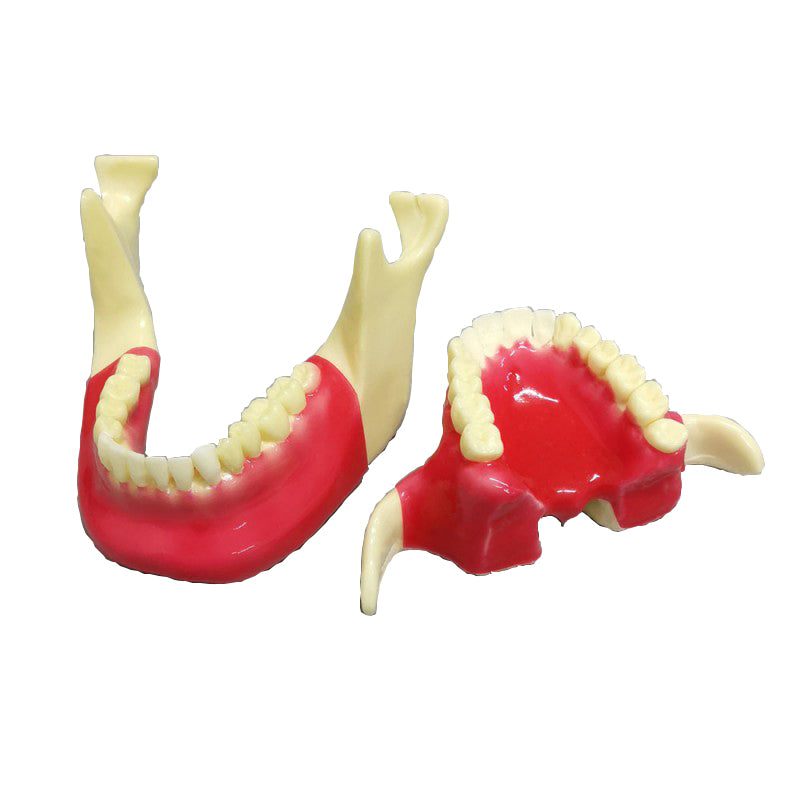 W2031 Dental Ortho Implant Practice Model