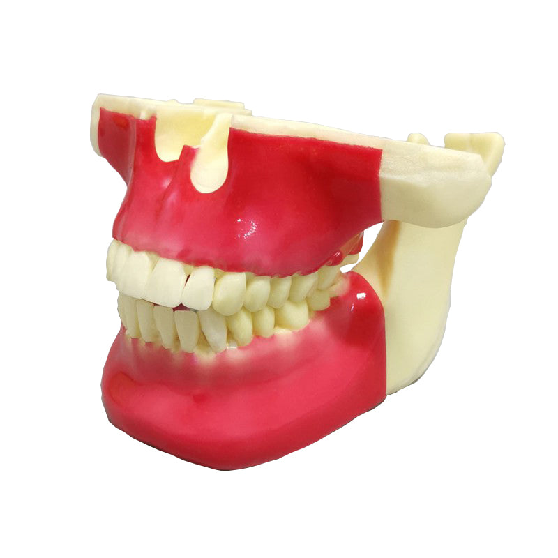 W2031 Dental Ortho Implant Practice Model