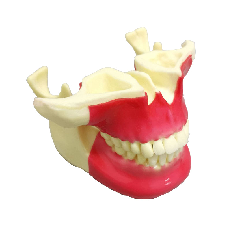 W2031 Dental Ortho Implant Practice Model