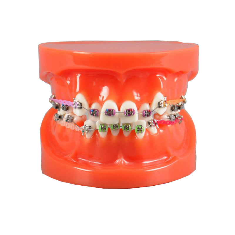 W3005 Dental Orthodontic Model with Metal Bracket and Elastic – Dr Wong ...