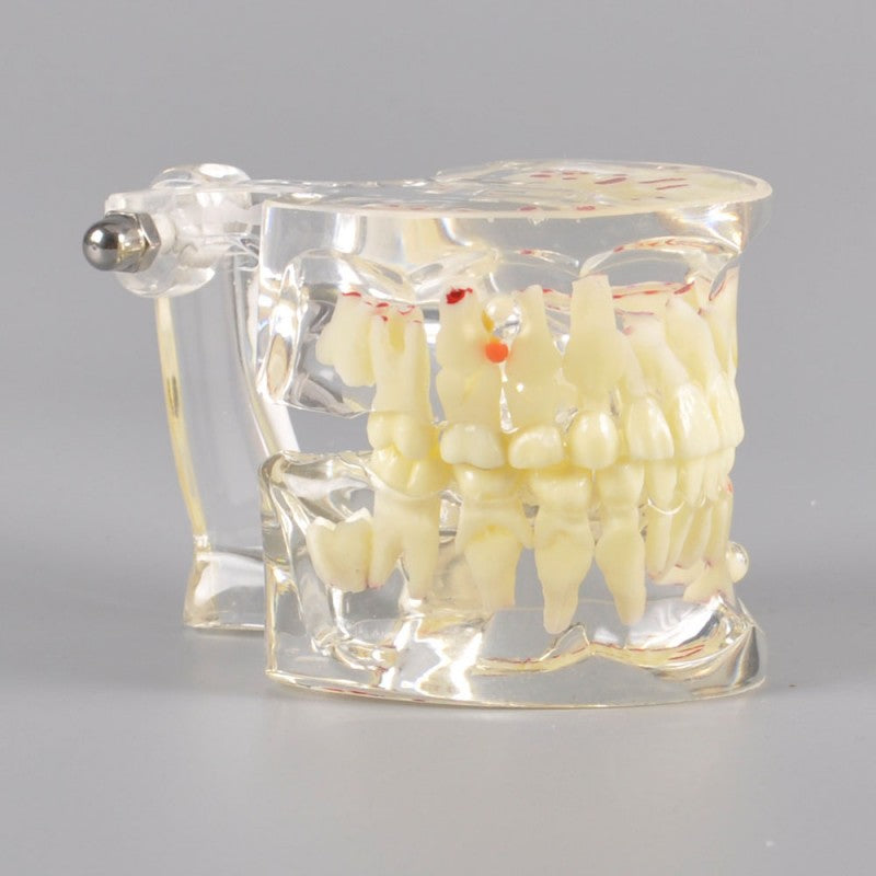 W4002 Pediatric Dental Model with Pathology