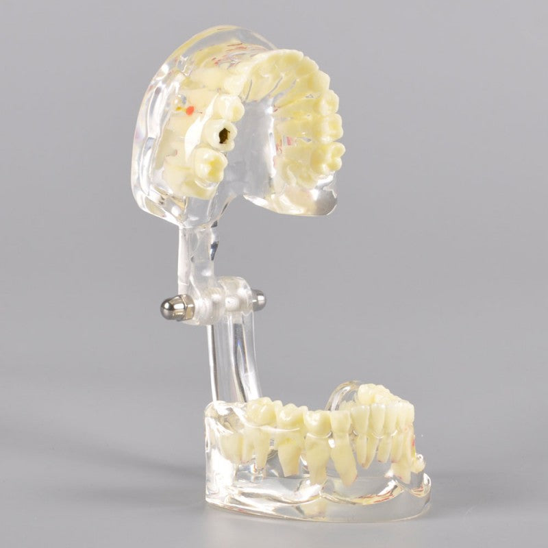 W4002 Pediatric Dental Model with Pathology