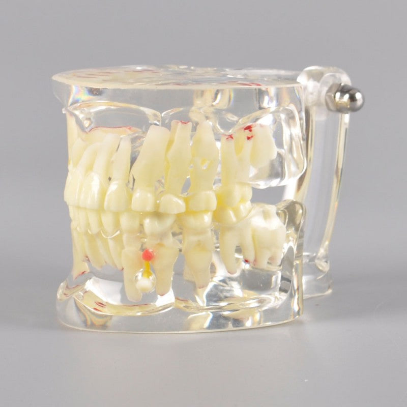 W4002 Pediatric Dental Model with Pathology