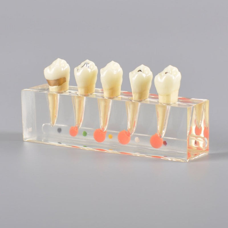 W4007-2 Dental Endodontic Treatment Model – Dr Wong Anatomy